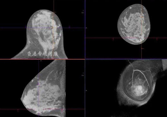 DS8201一个月需要用几支多少钱如何计算用量参考方案_财富号_东方财富网