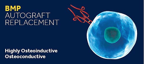 国产首个！骨科创新产品获批上市，对标美敦力、史赛克_财富号_东方财富网