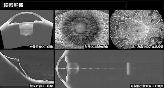 如意全眼OCT线下首发获世界眼科论坛路演第一，视微开创全眼OCT新时代_财富号_东方财富网